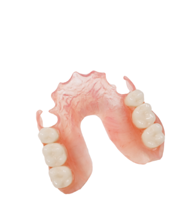 In the Dentist Bag of Tricks: Should a Flexible Partials