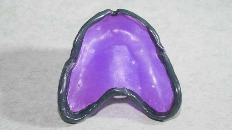 Traditional vs Digital Dental Impressions for Dentures