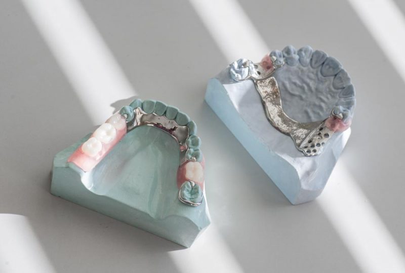 Types of Partial Dentures and Costs - STOMADENT