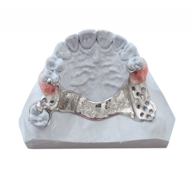 Cast Metal Partial Denture Reline or Rebase: Is It Worth It? - STOMADENT
