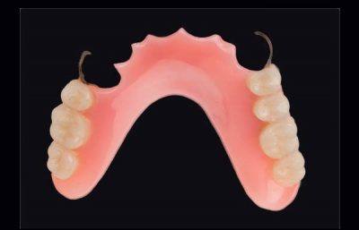 Types of Partial Dentures and Costs - STOMADENT