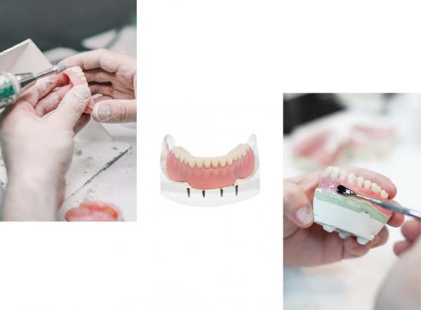 Top-Rated Denture Lab | Stomadent Dental Lab