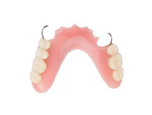 Valplast Partial Denture Framework — Stomadent Dental Laboratory Valplast Partial Denture Framework — Stomadent Dental Laboratory