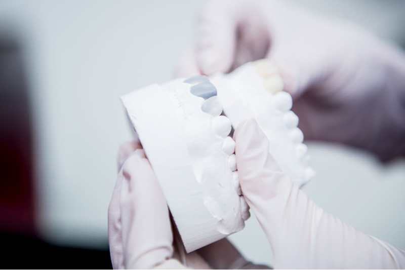 What You Need To Know About Denture Relines| Stomadent Lab