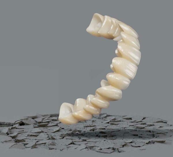 Zirconia over PMMA Denture - STOMADENT