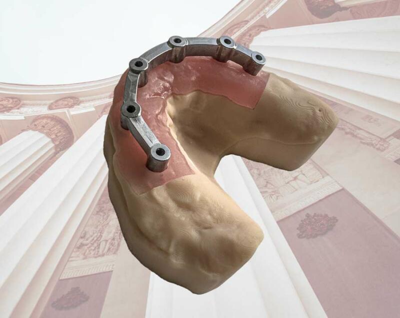 Milled Fixed Titanium Bars - STOMADENT