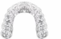 Partial Denture Clasp Types | Stomadent Dental Lab