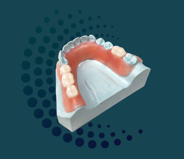 Valplast Partial Denture Framework — Stomadent Dental Laboratory