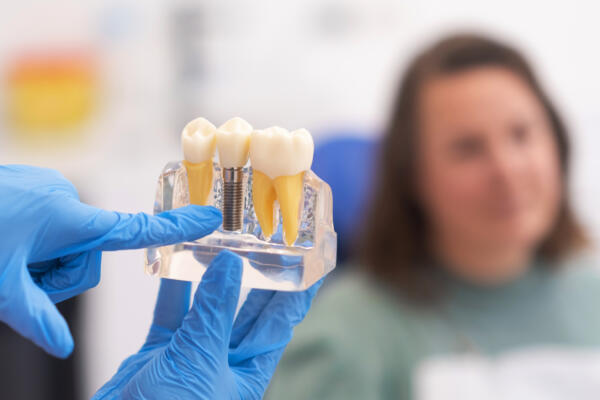 PFM Crowns - Stodament Dental Laboratory