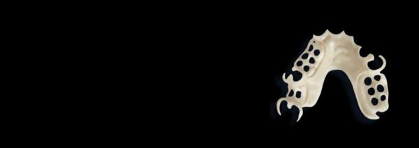 Zirlux Acetal Resin Partial Dentures - Stomadent Dental Lab