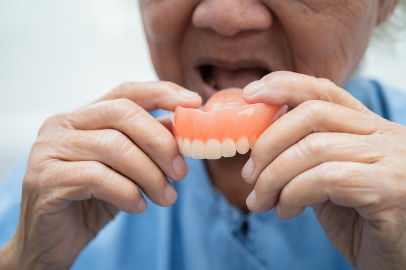Traditional vs Digital Dental Impressions for Dentures
