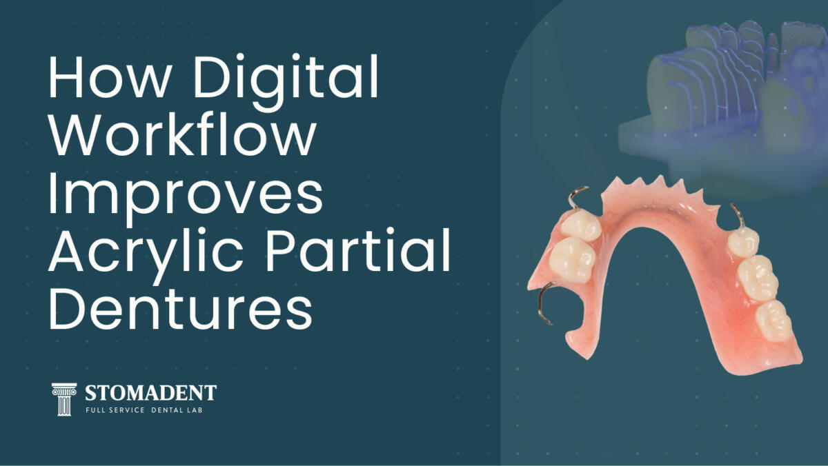 Interim Partial Denture Uses & Options - STOMADENT